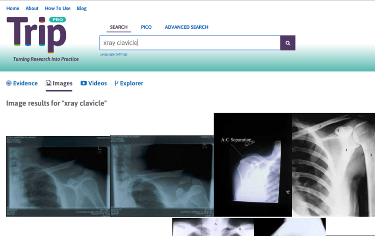 Medical images on Trip – Trip Database Blog